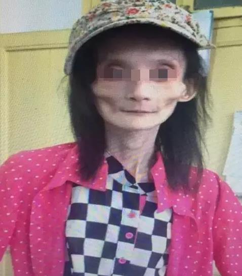 Anorexia in China - Same, But Different | Eye on Digital China